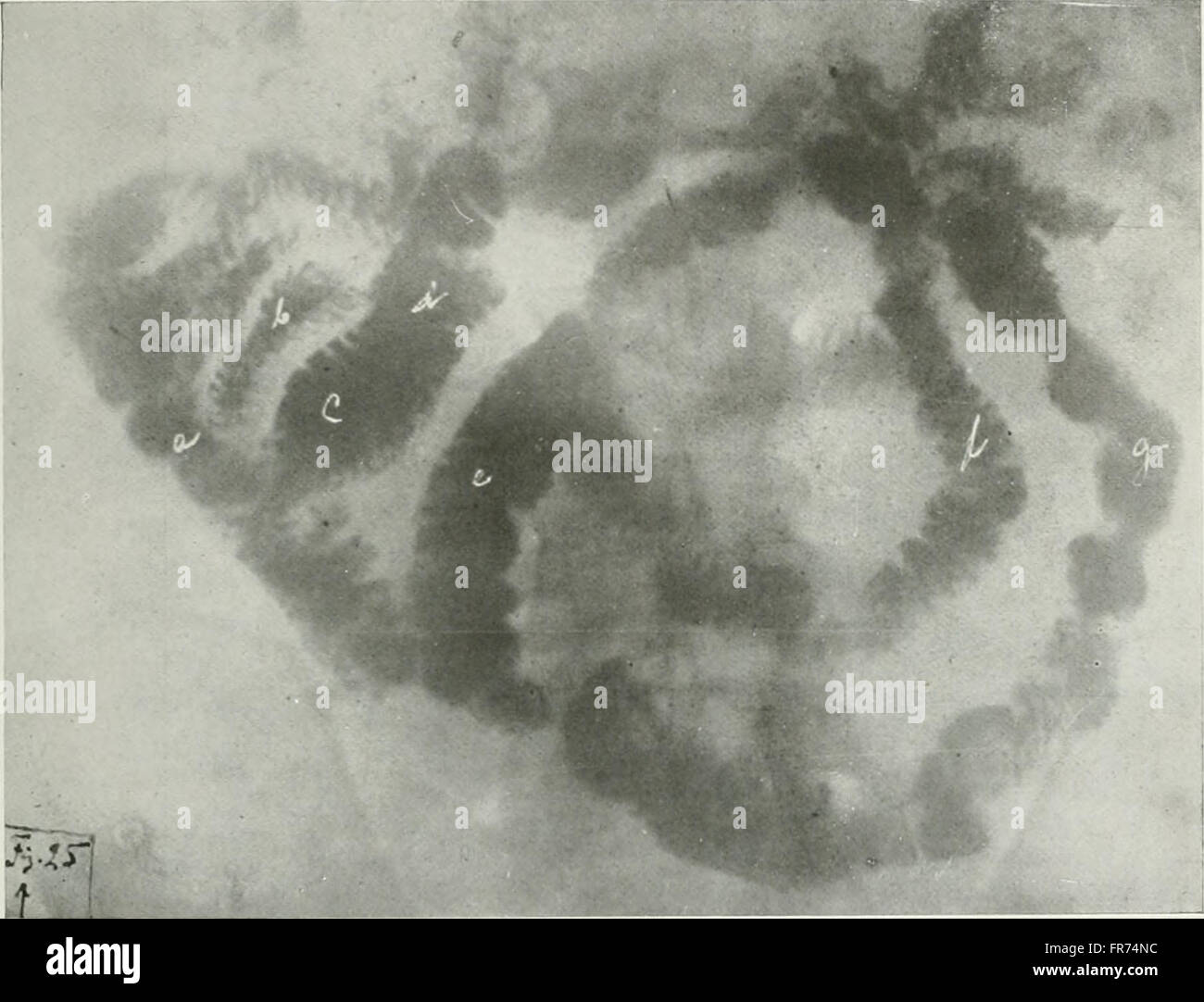 *The American Journal of Roentgenology, Radium Therapy, and Nuclear ...