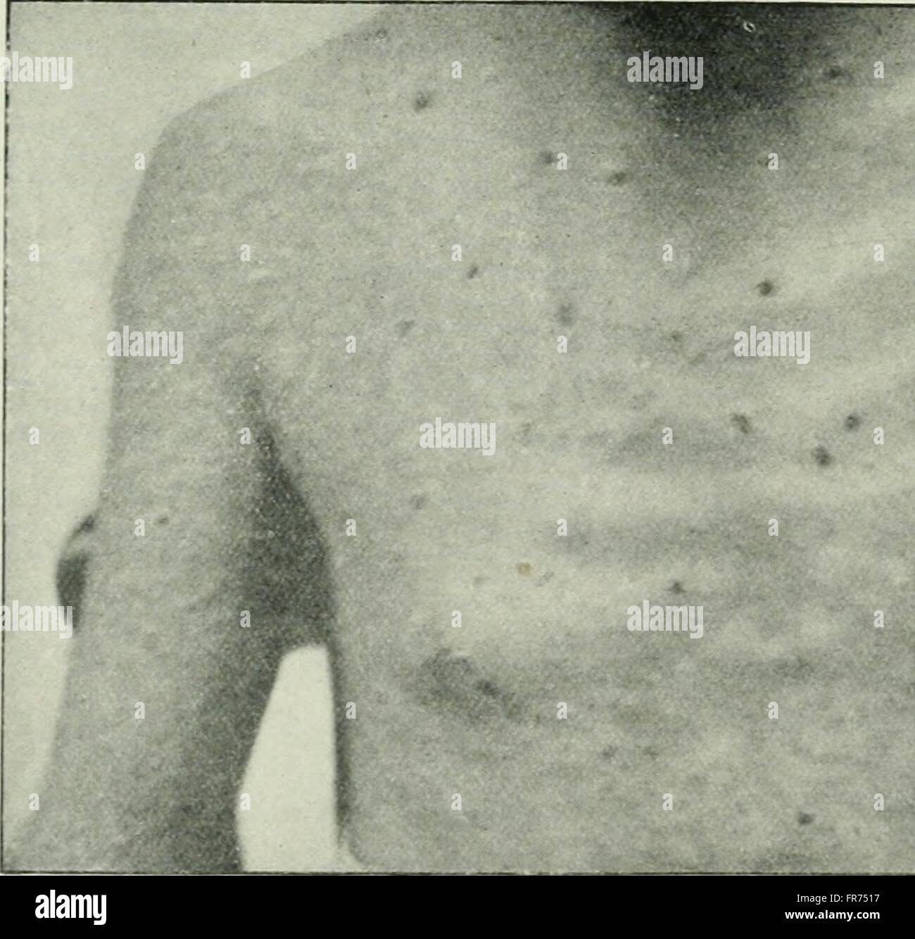 The British Journal of Dermatology (1888) publishes research on skin ...