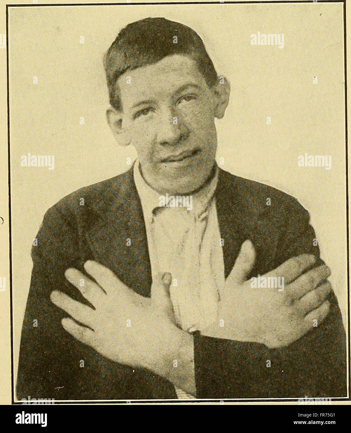 Types of mental defectives (1920 Stock Photo - Alamy