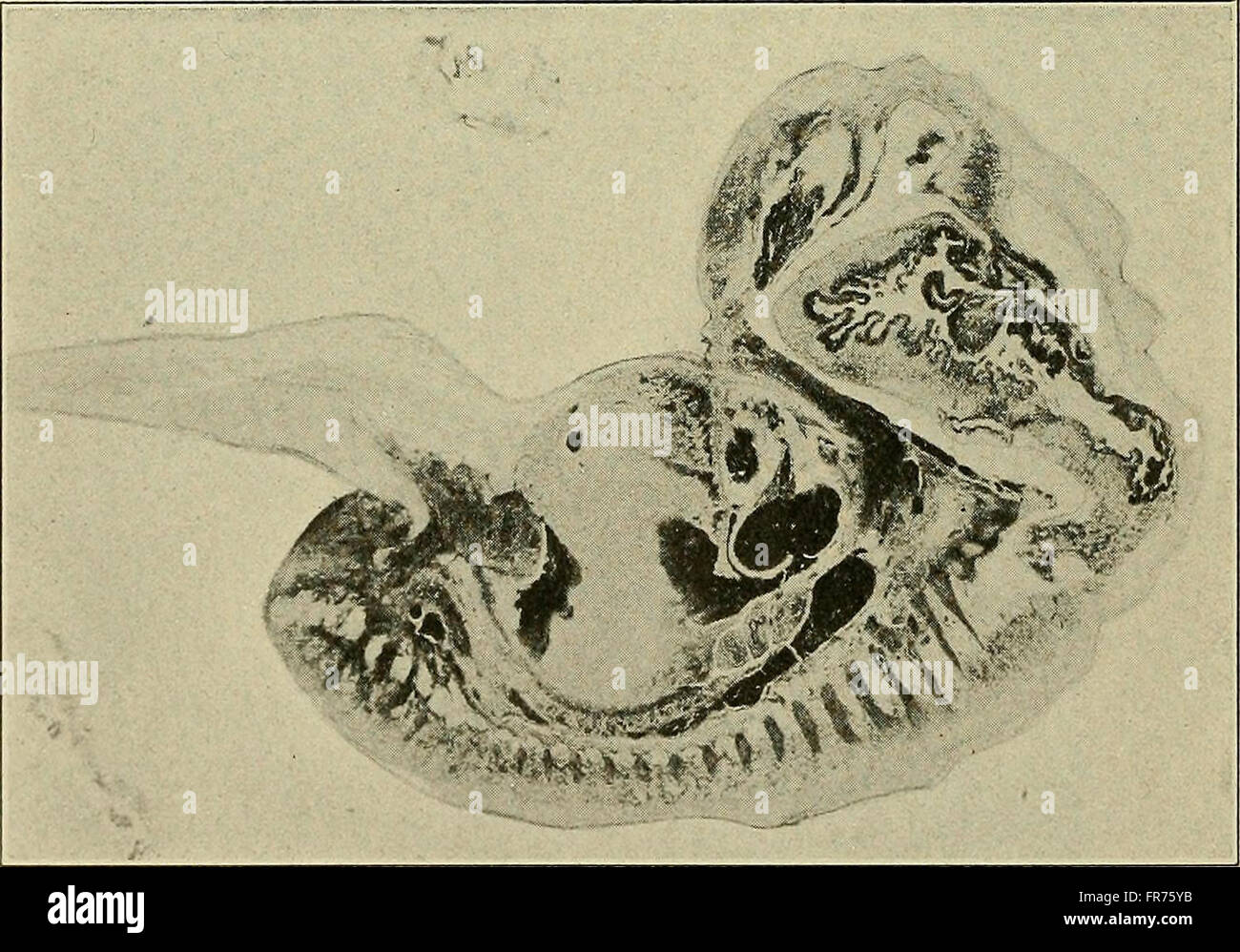 This 1908 study explores the pathological causes behind the origin of ...