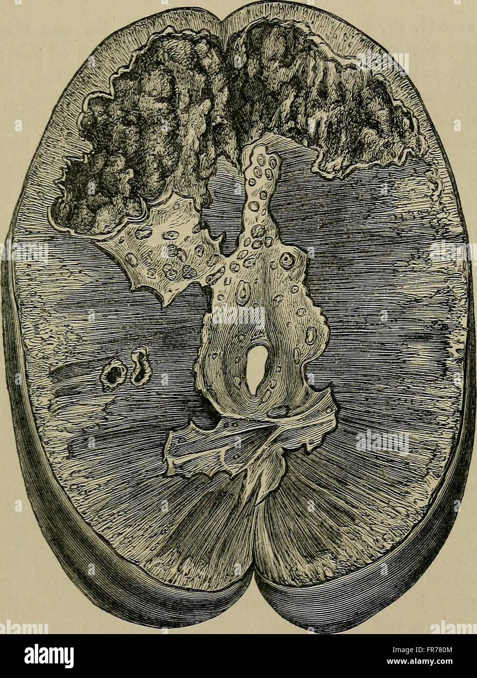 This 1879 treatise covers the study of urinary and renal diseases ...