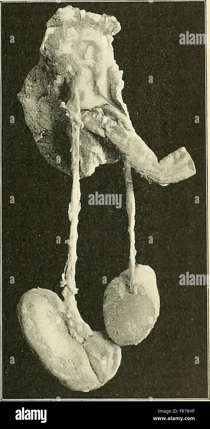 This text-book provides in-depth medical knowledge on genito-urinary ...