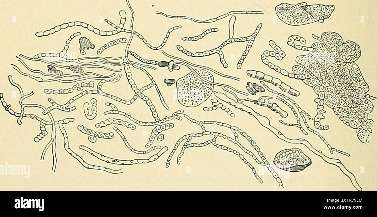 ‘An American Text-Book of Genito-Urinary Diseases, Syphilis and ...