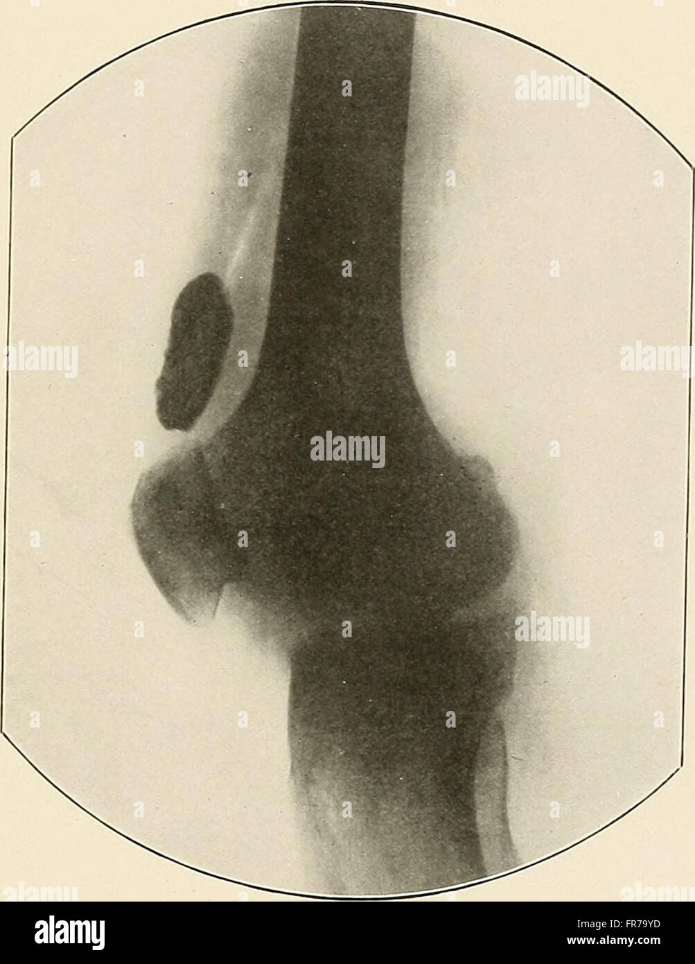 This 1911 atlas presents detailed radiographs of pathological changes ...