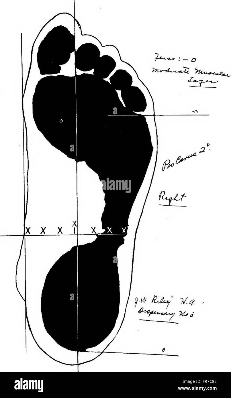 Proper shoe sizing hi-res stock photography and images - Alamy