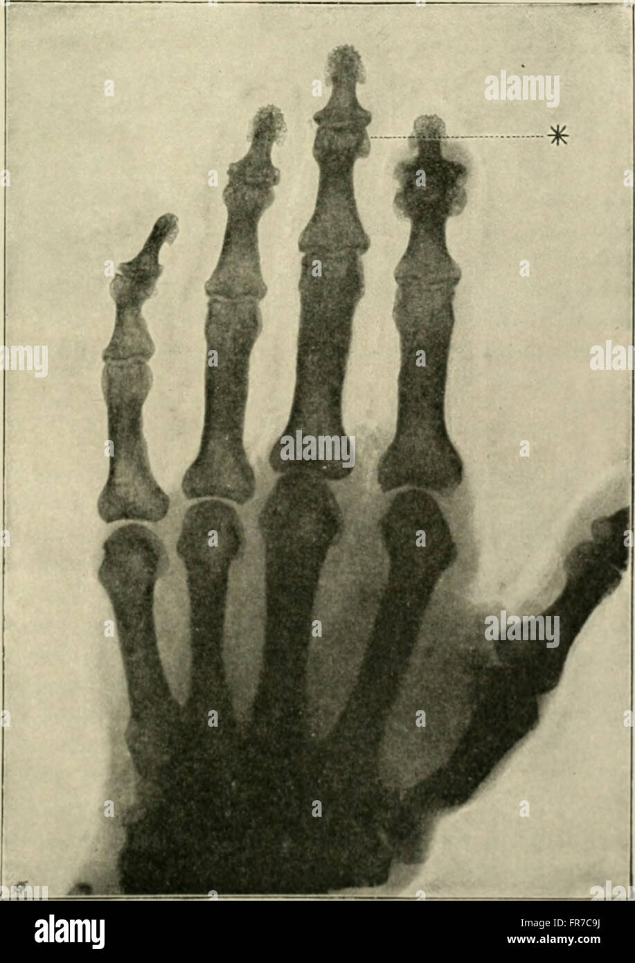 Animal blood scan hi-res stock photography and images - Alamy