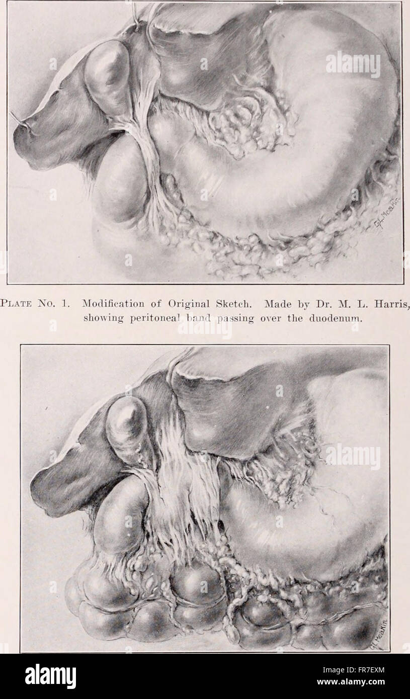 The 1919 'Journal of Roentgenology' covers advancements in radiology ...