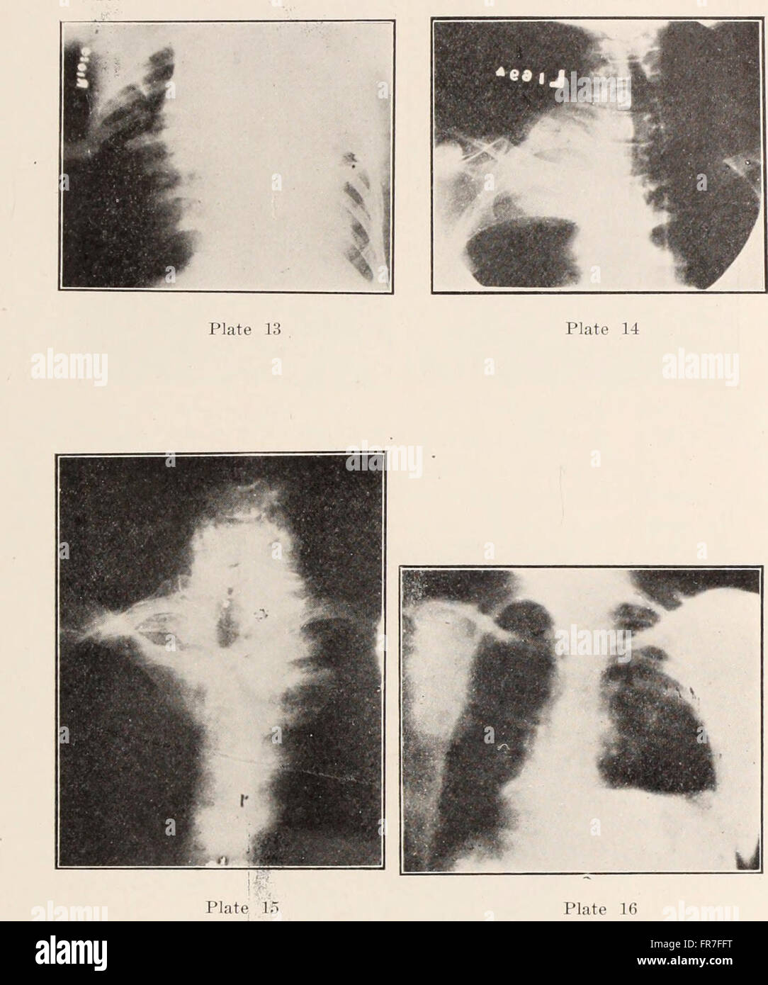 The *Journal of Roentgenology* (1918) publishes research on X-ray ...
