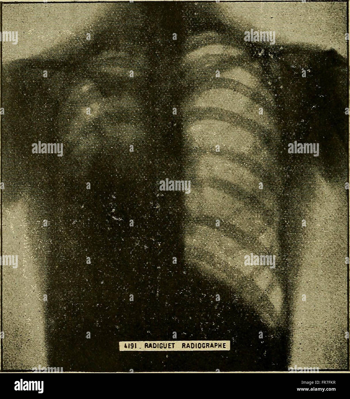 A 1900 manual detailing the use of X-rays in radiography and radioscopy ...