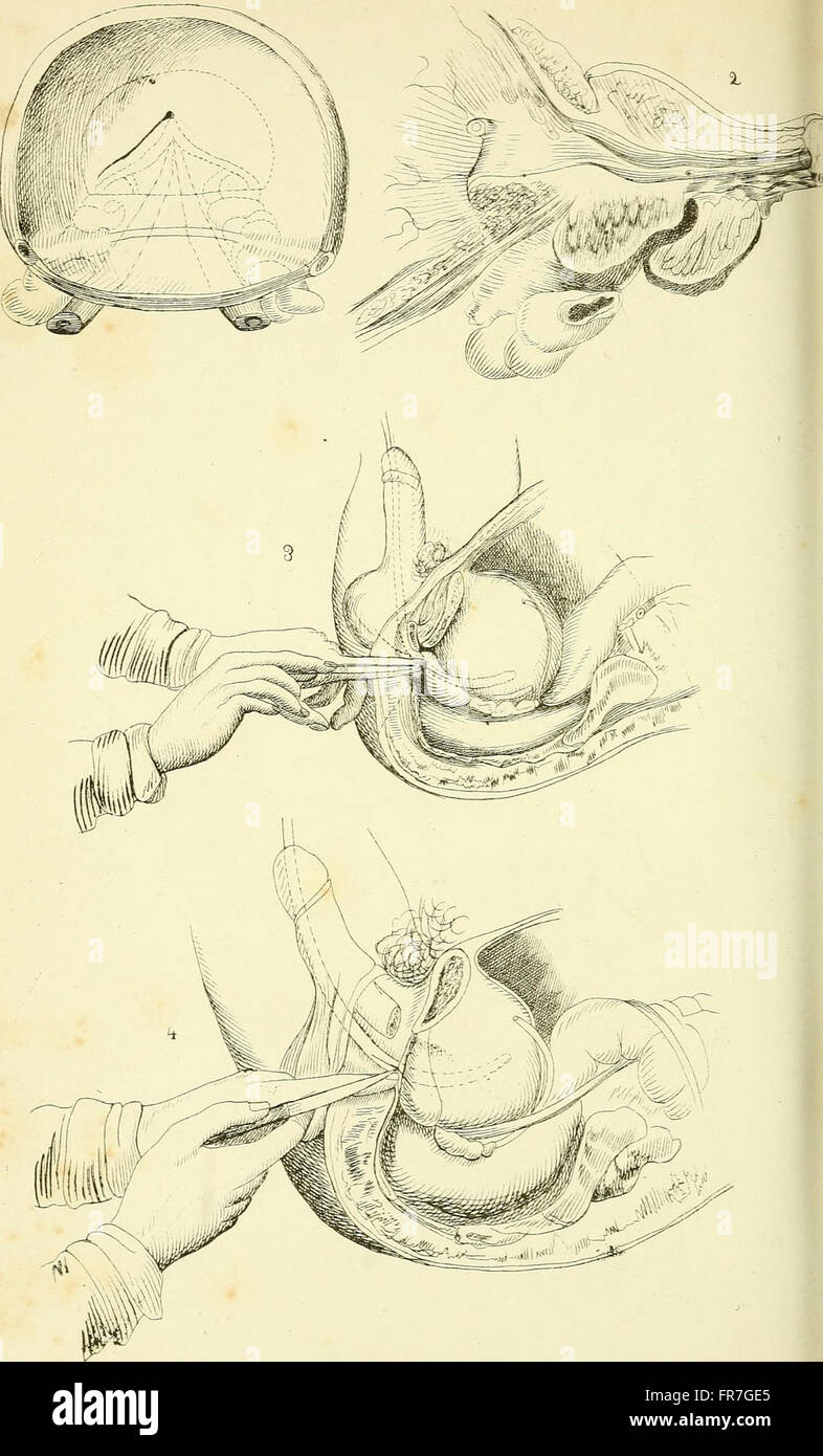 'Operative Surgery Illustrated' (1852) is a comprehensive surgical ...