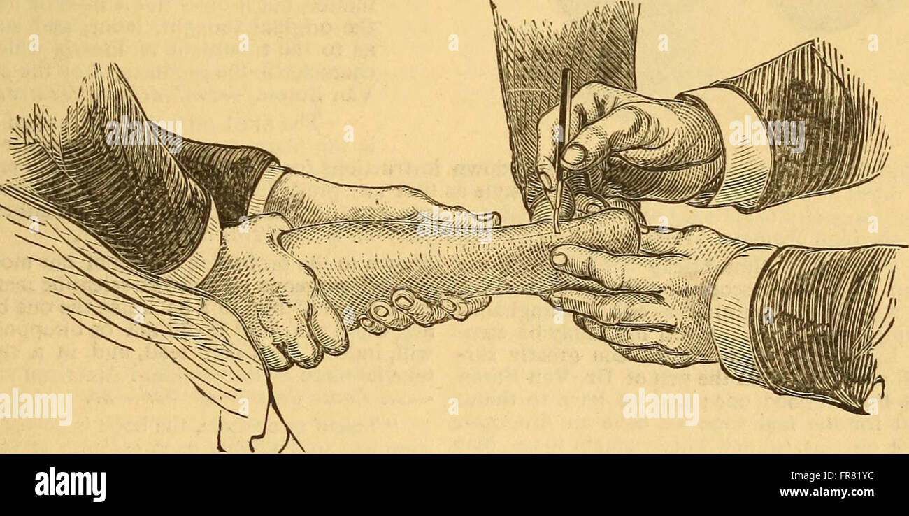 Outlines of the pathology and treatment of syphilis and allied venereal ...