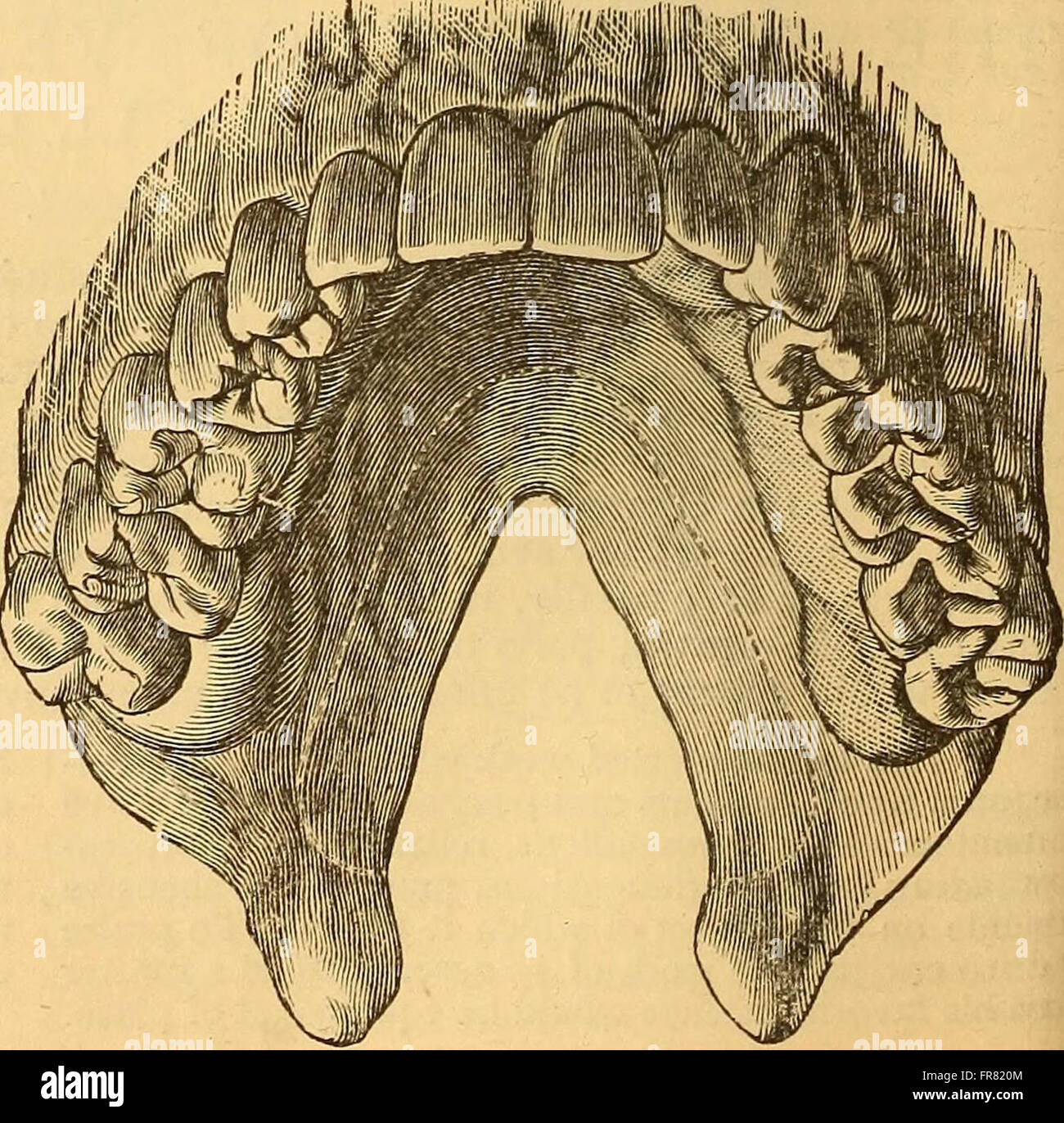 Outlines of the pathology and treatment of syphilis and allied venereal ...