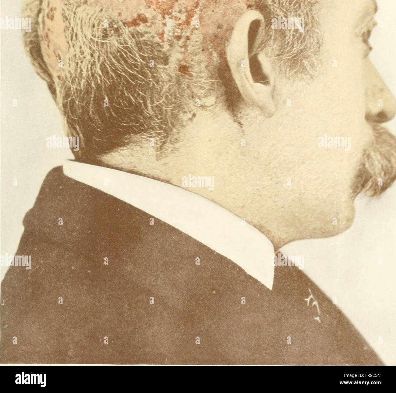 Atlas of skin diseases hi-res stock photography and images - Alamy