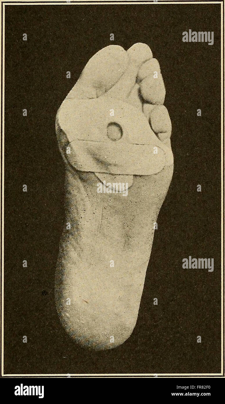 'Practical Podiatry' (1918) offers a comprehensive guide to the study ...