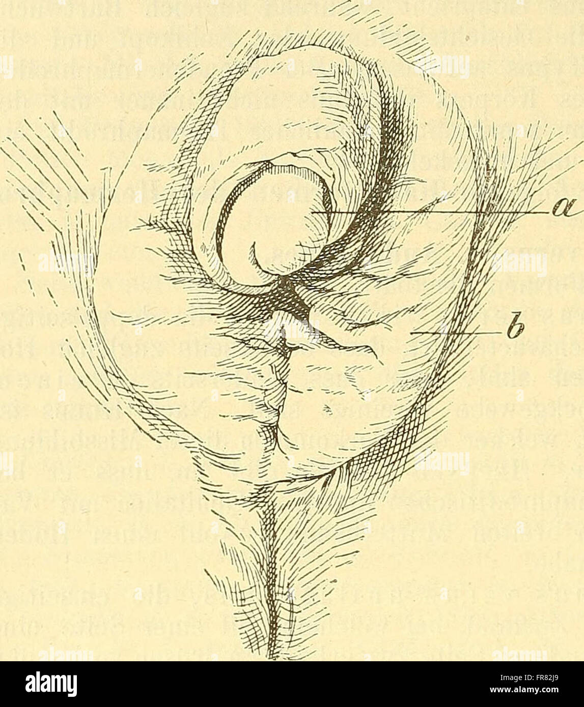 This 1887 textbook focuses on general pathological anatomy and ...