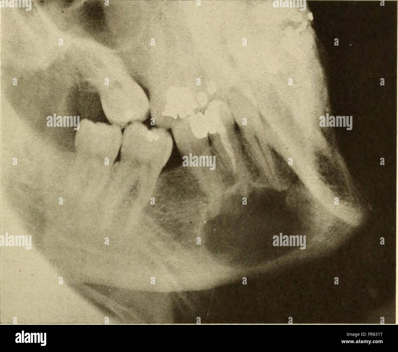 Oral Roentgenology - a Roentgen study of the anatomy and pathology of ...