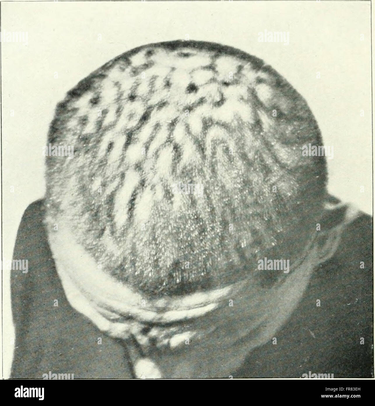 The 1888 edition of The British Journal of Dermatology discusses ...