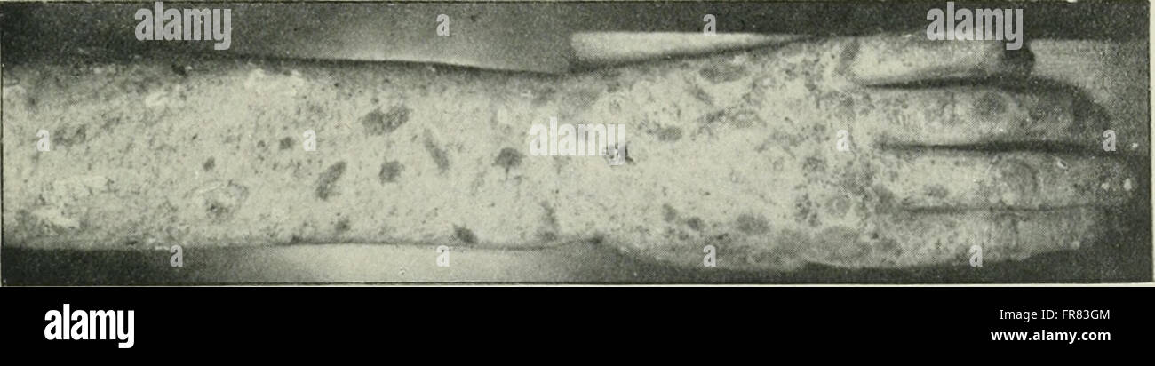 'The British Journal of Dermatology' (1888) focuses on the study and ...