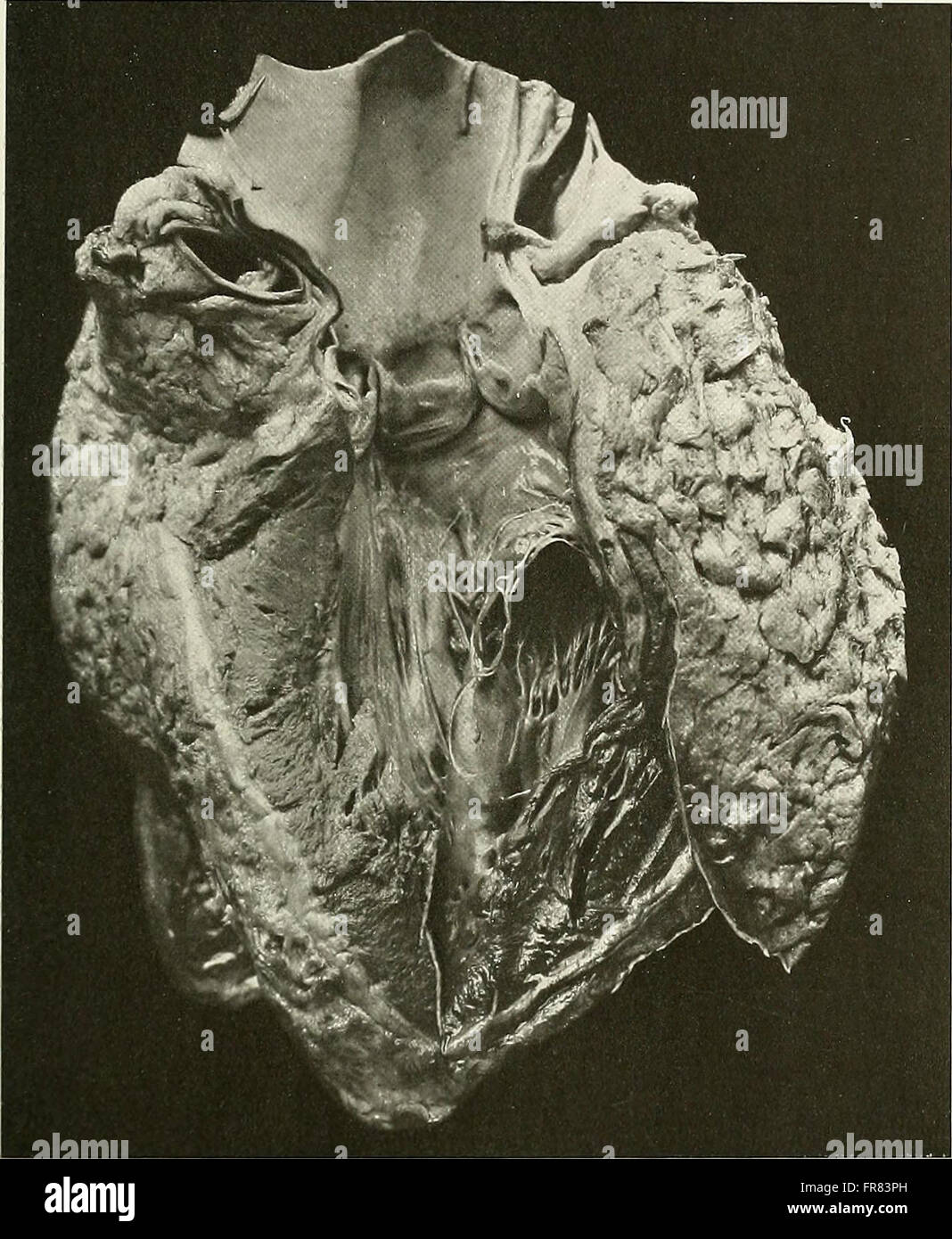 'Studies in Cardiac Pathology' (1911) provides a thorough analysis of ...
