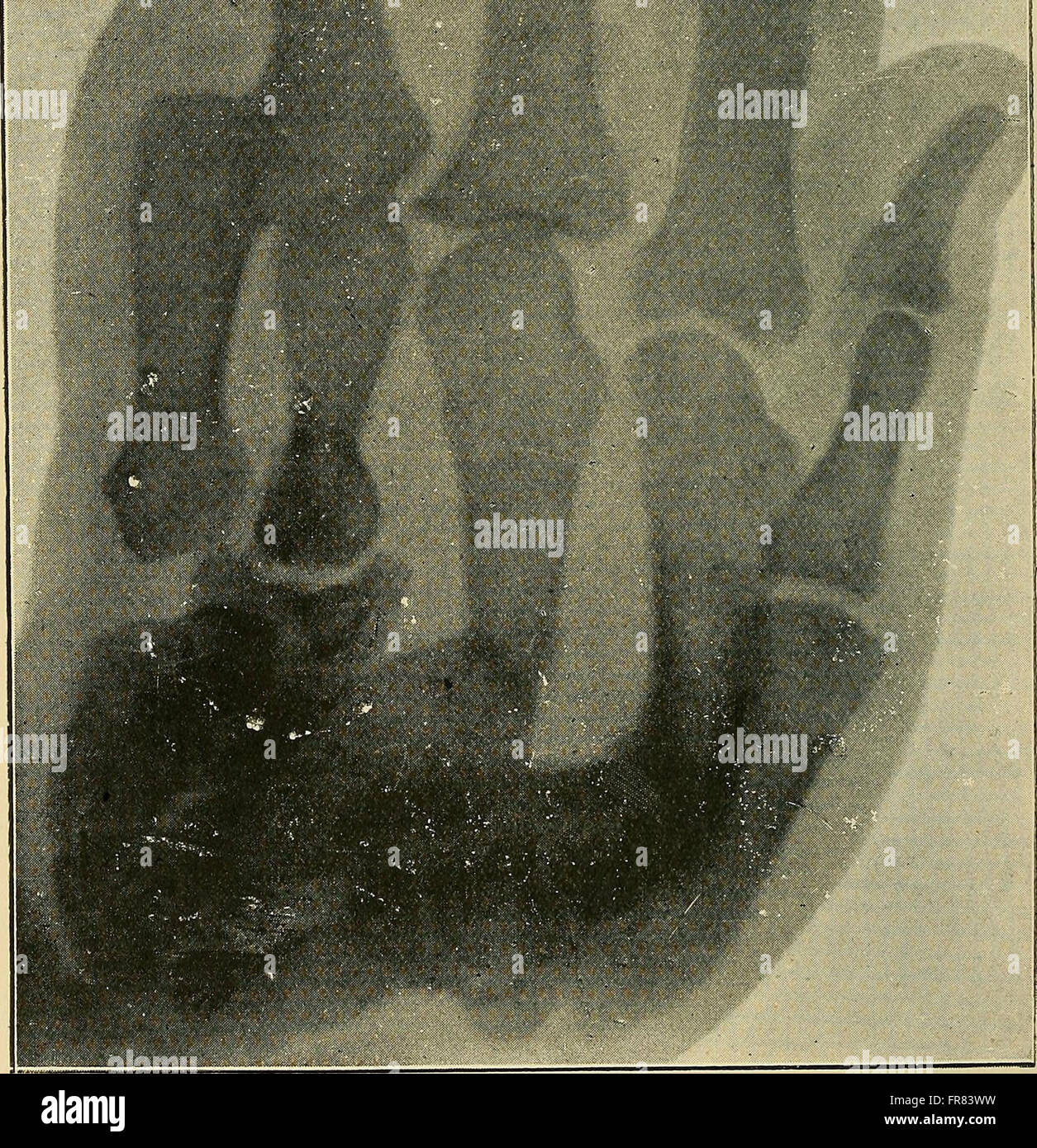 This 1907 medical paper explores the use of Röntgen rays (X-rays) in ...