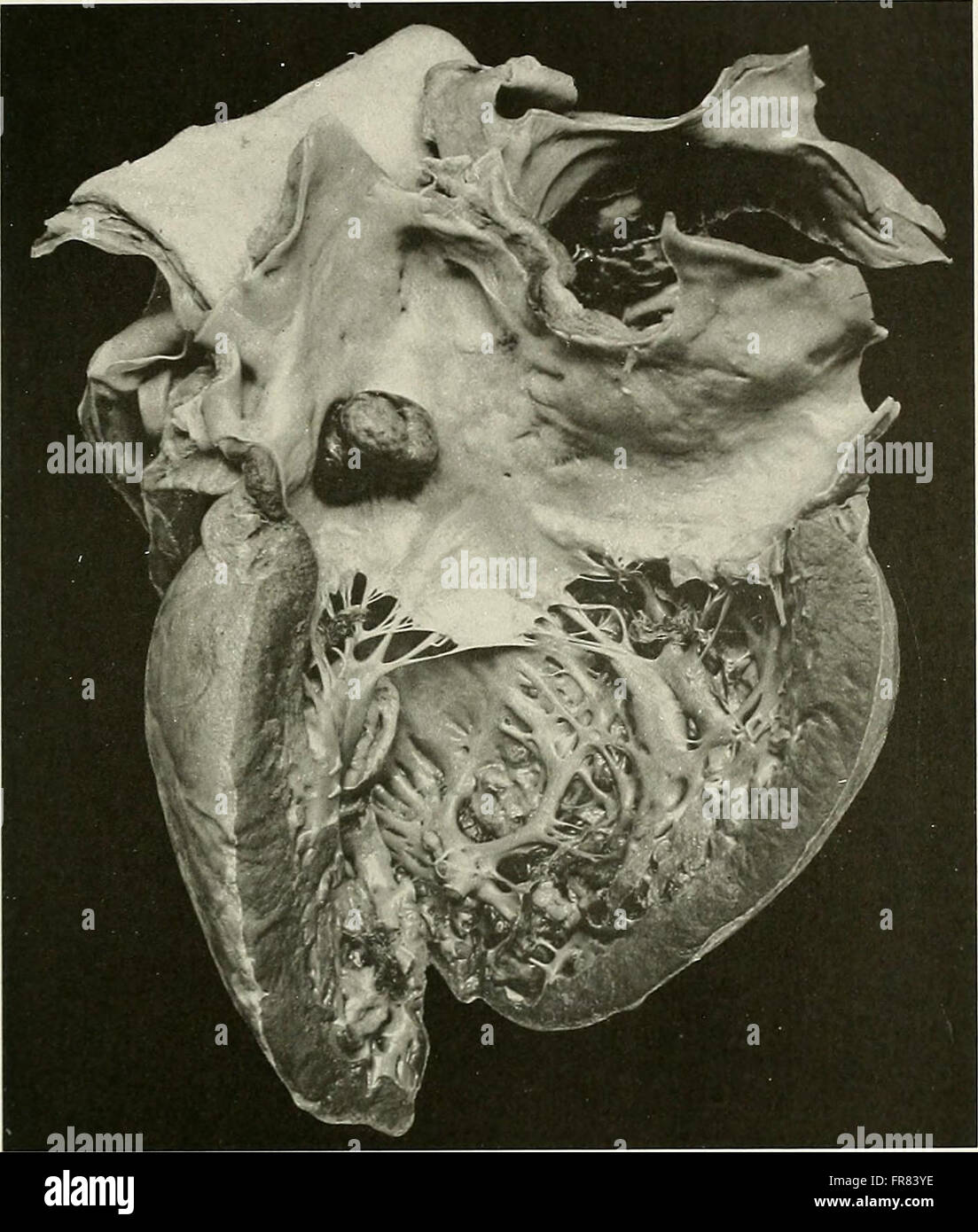 'Studies in Cardiac Pathology' (1911) explores the causes and effects ...