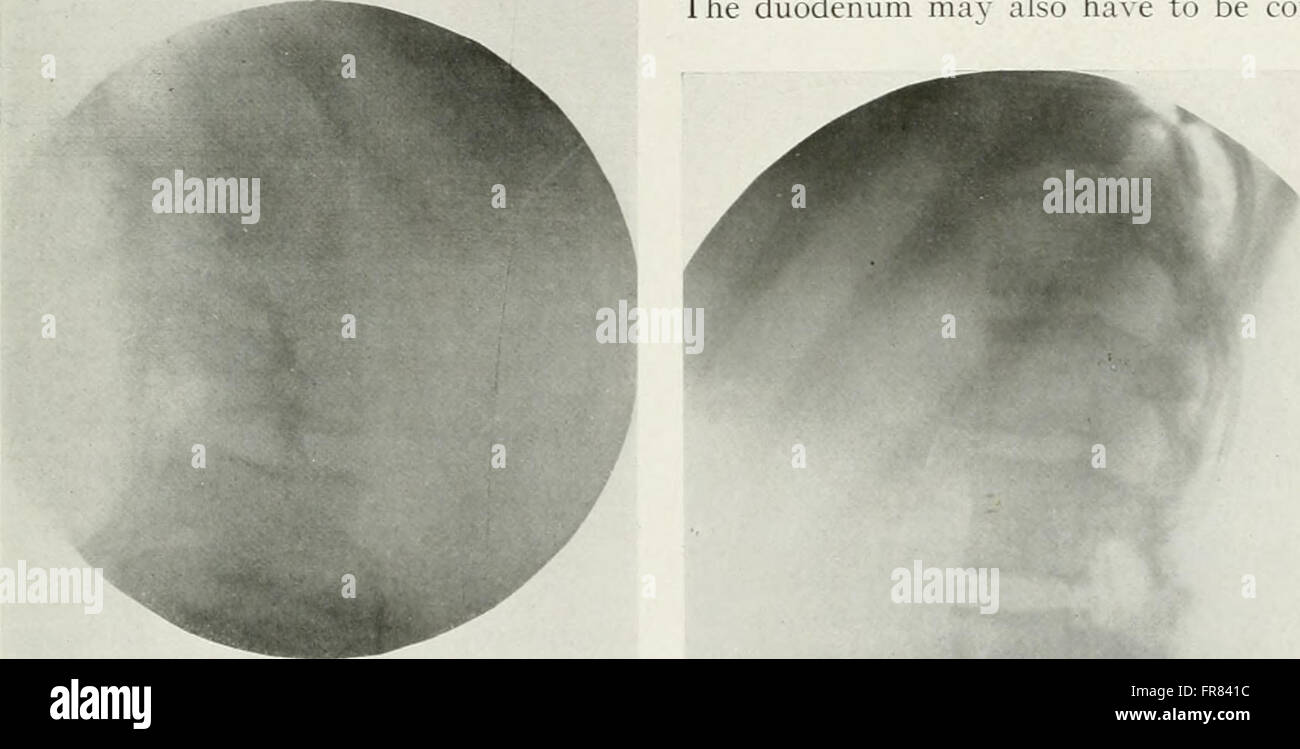 'The American Journal of Roentgenology, Radium Therapy and Nuclear ...
