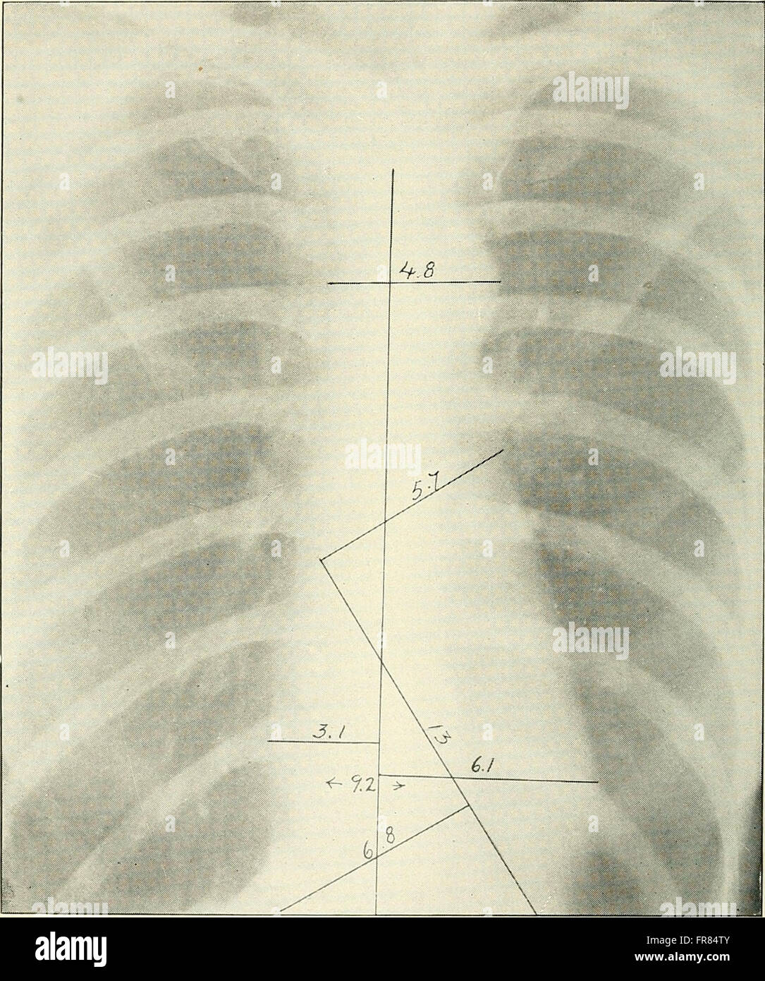 This 1919 manual provides a comprehensive guide to the interpretation ...
