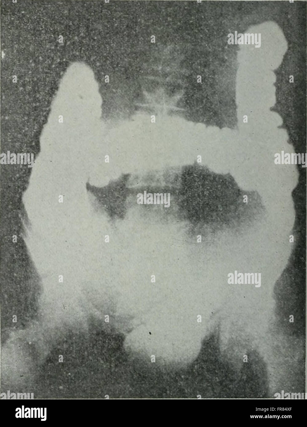 A 1906 journal dedicated to advancements in radiology, radium therapy ...