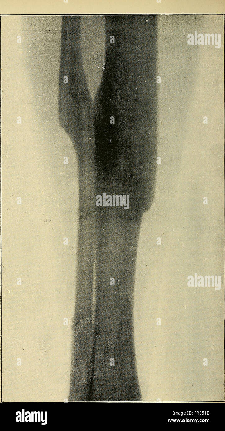 'The Röntgen Rays in Medical Work' (1907) discusses the use of X-rays ...