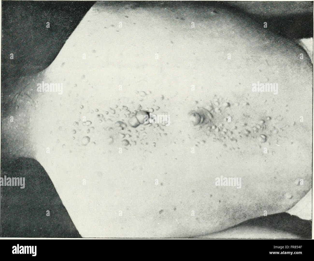 The British Journal of Dermatology (1888) offers a range of studies and ...