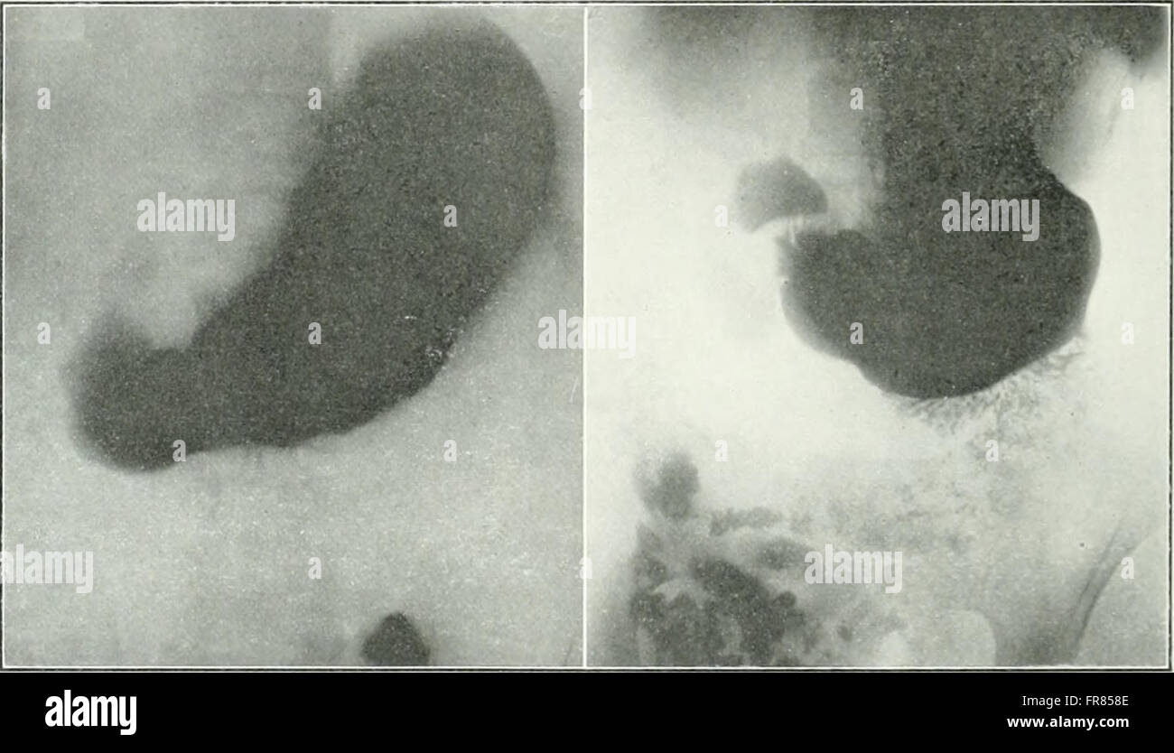 A journal from 1906 covering advancements in medical imaging, radium ...