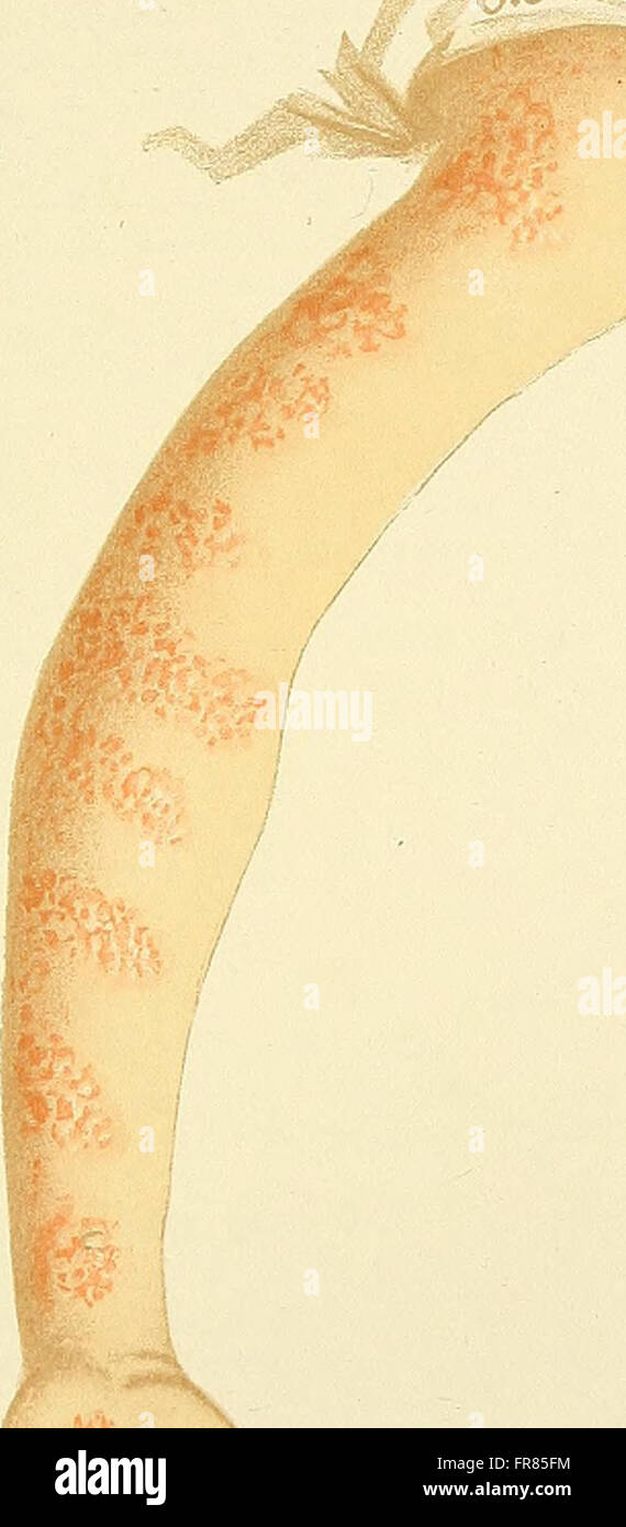 An American text-book of genito-urinary diseases, syphilis and diseases ...