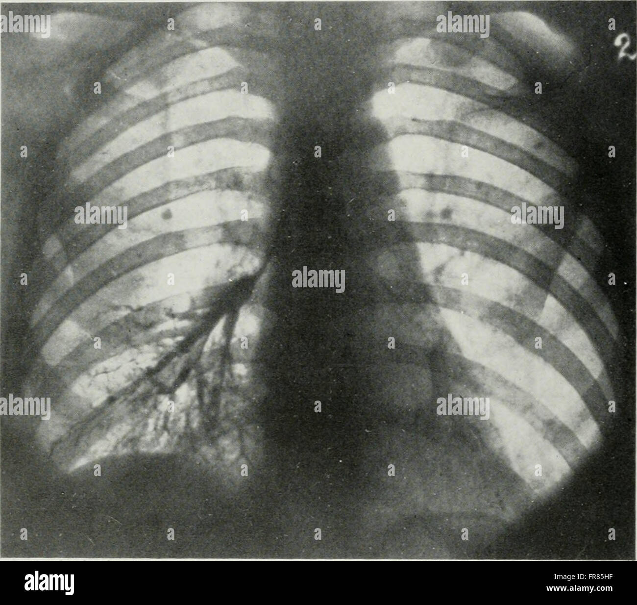 This 1906 journal covers the emerging fields of roentgenology, radium ...