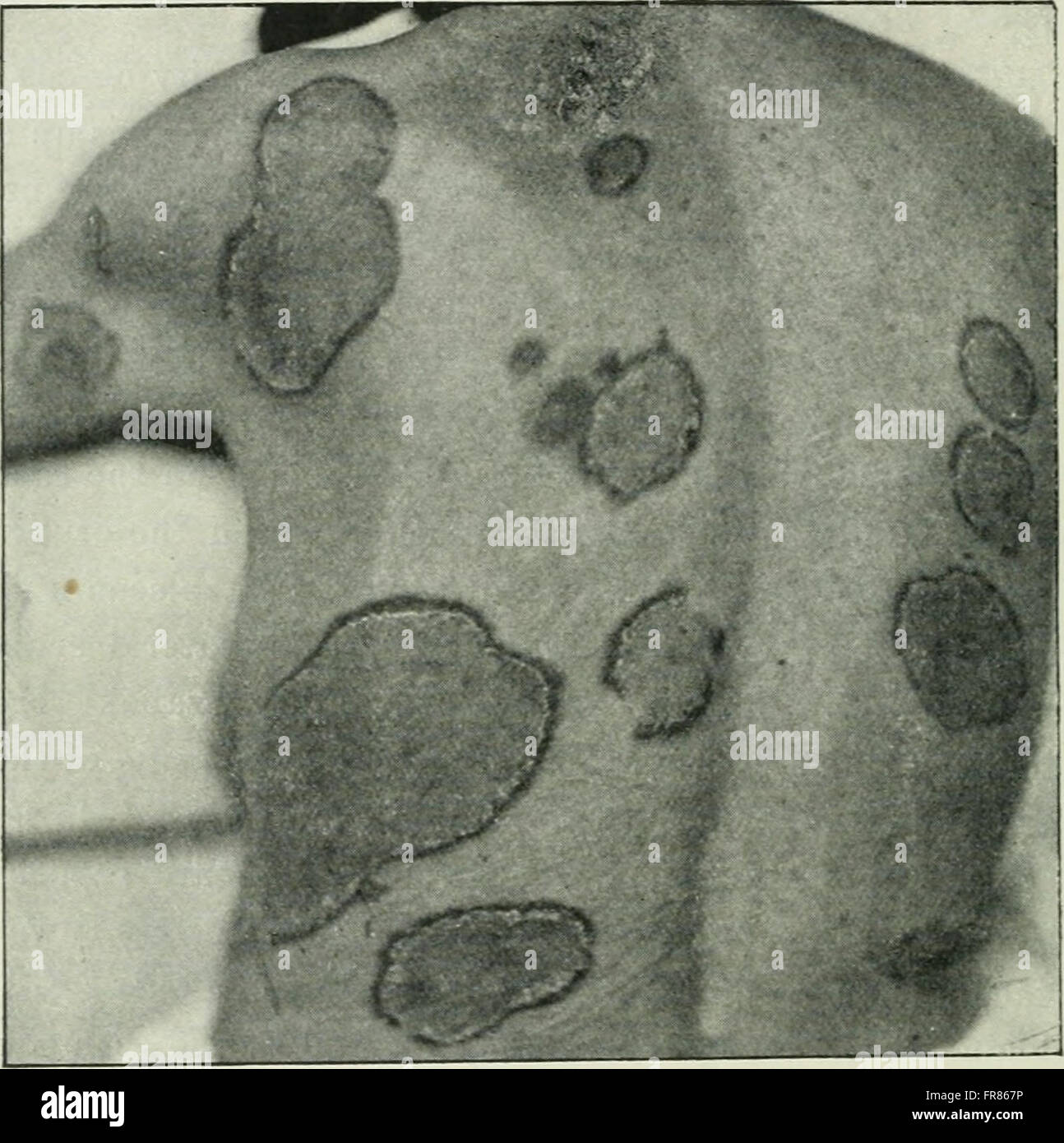 The British Journal of Dermatology (1888) is a medical publication ...
