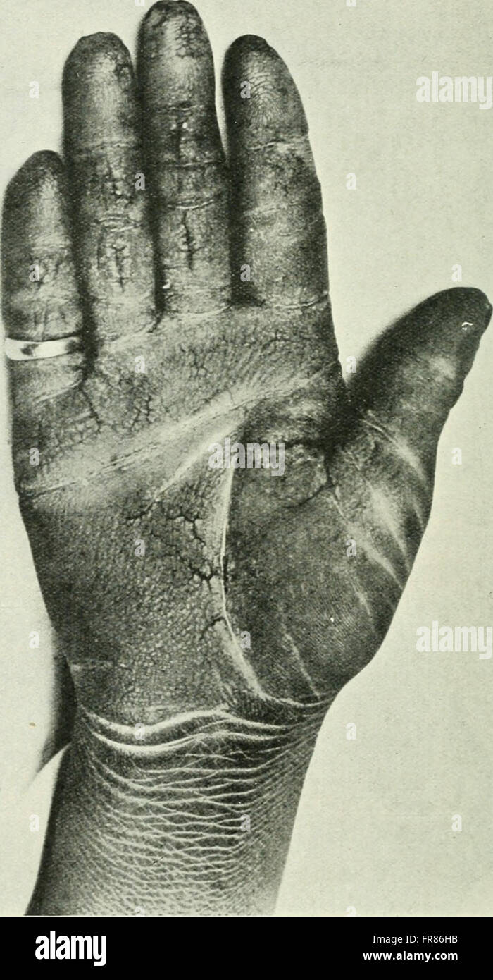 The British Journal of Dermatology (1888) covers advancements in the ...