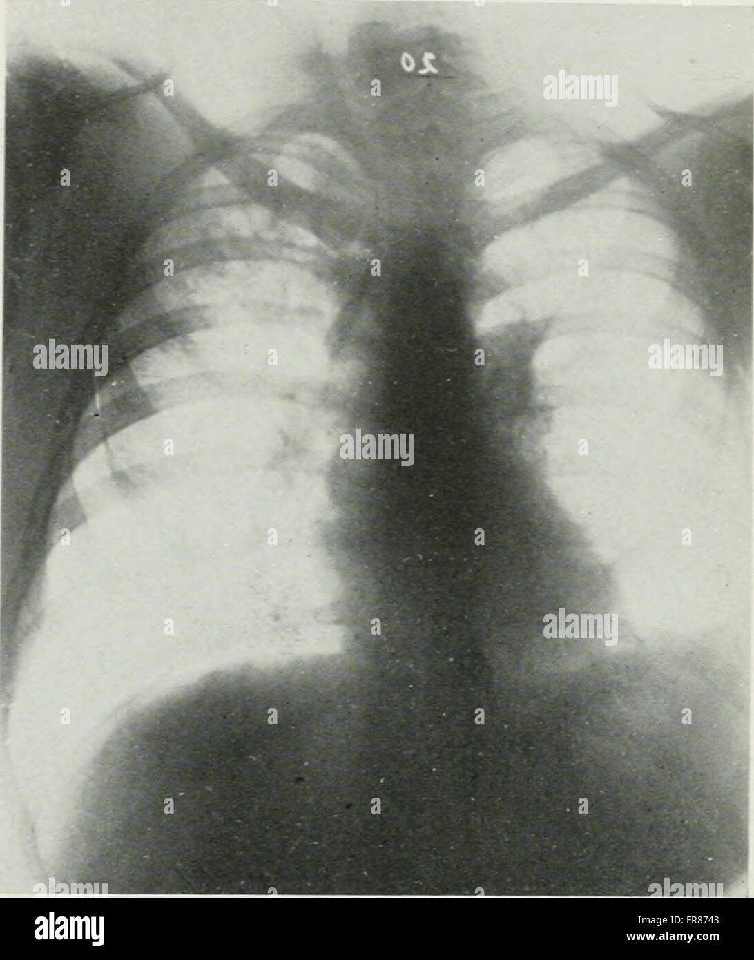 The American Journal of Roentgenology, Radium Therapy, and Nuclear ...