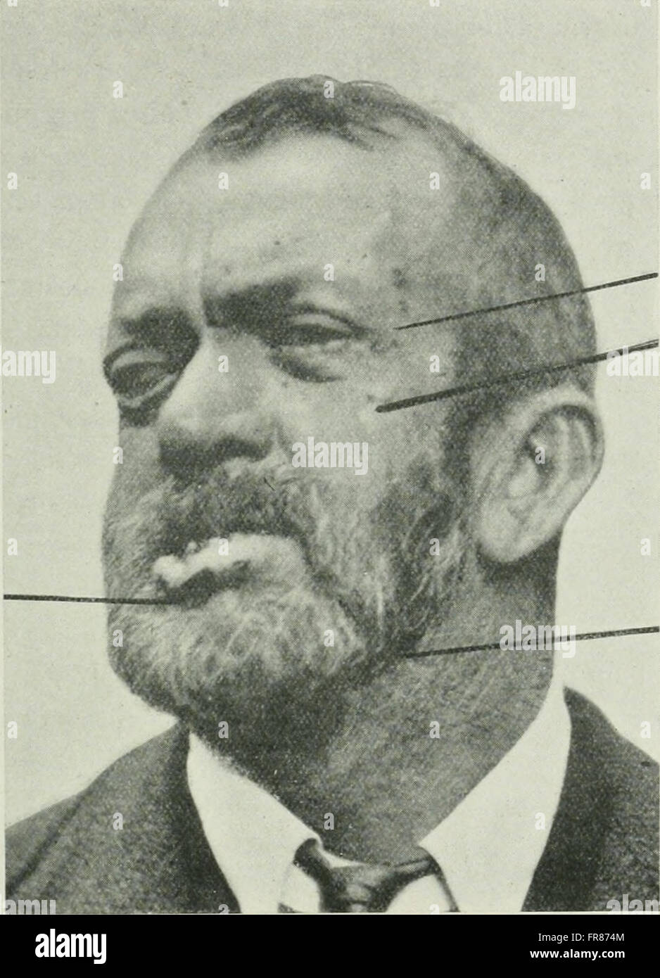 The *British Journal of Dermatology* (1888) focuses on advancements in ...
