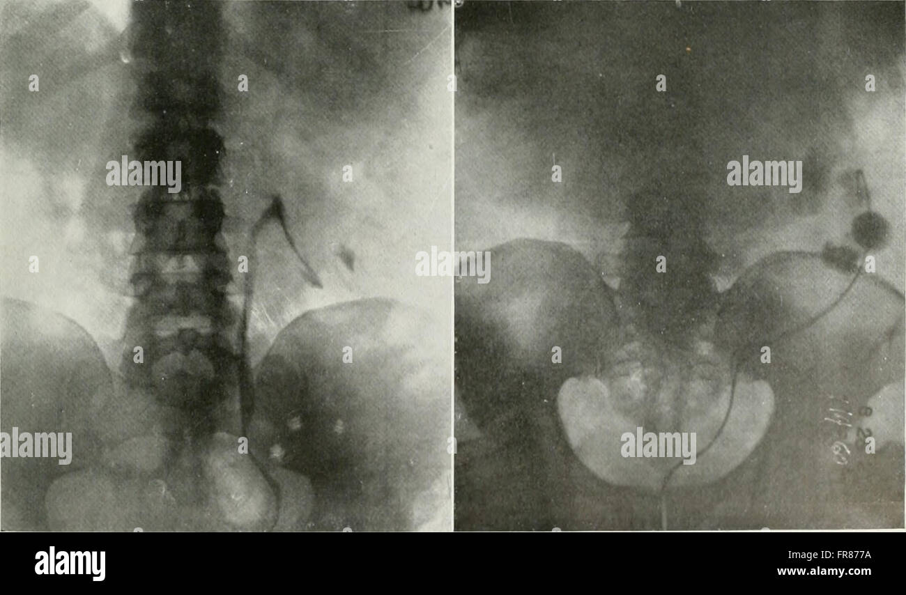 This 1906 journal covers the early developments of roentgenology (X-ray ...