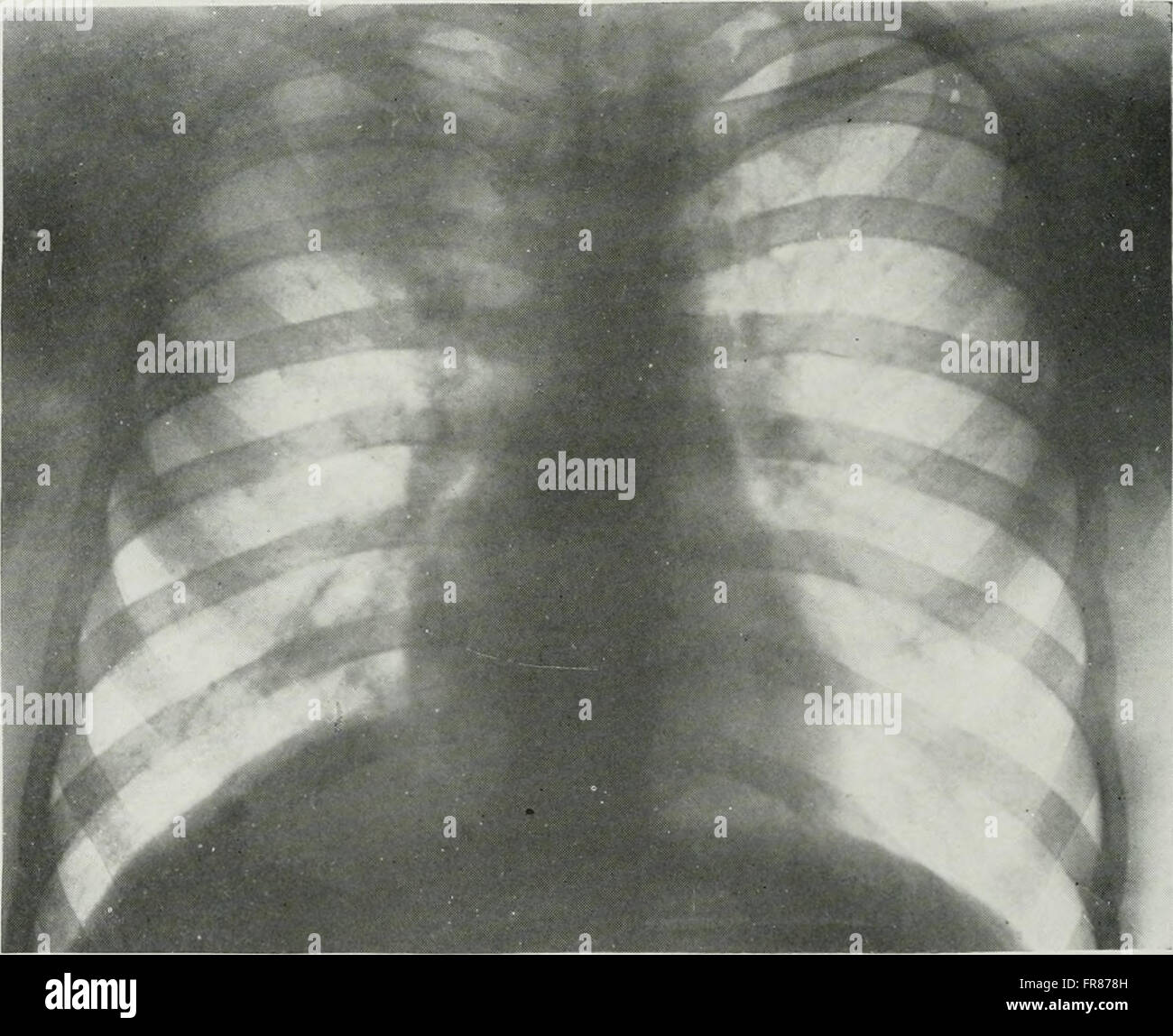 A 1906 journal issue focusing on advancements in roentgenology, radium ...
