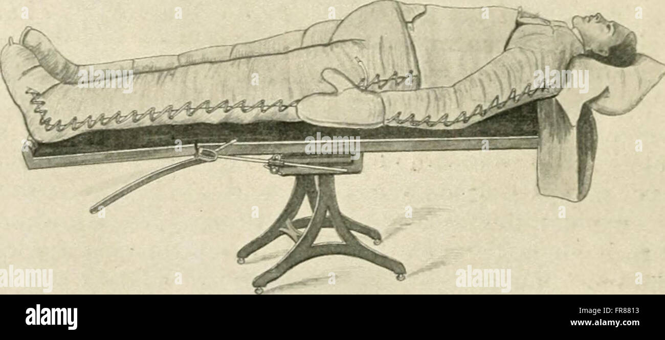 This 1910 text outlines surgical practices and techniques in the early ...