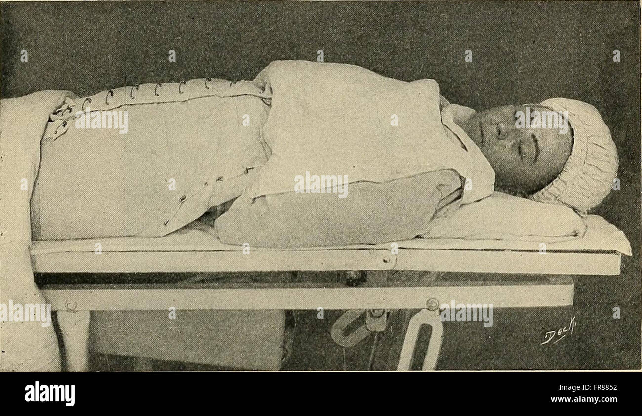 This 1913 manual provides guidance on pre- and post-operative care ...