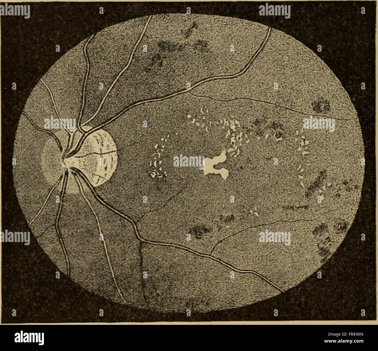 The 1919 Textbook of Ophthalmology provides a comprehensive overview of ...