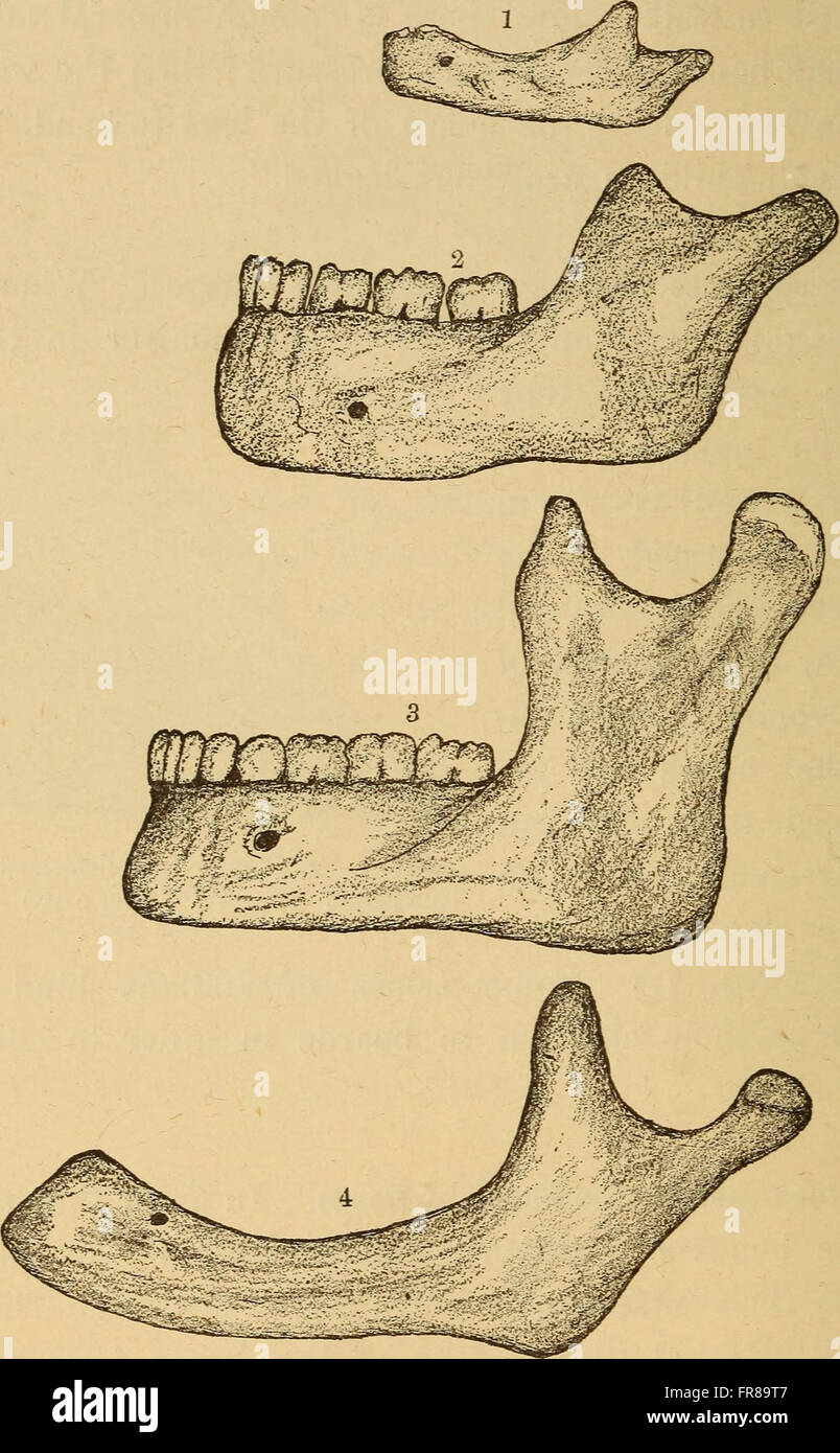 A Healthy Body (1889) is an educational textbook focusing on anatomy ...