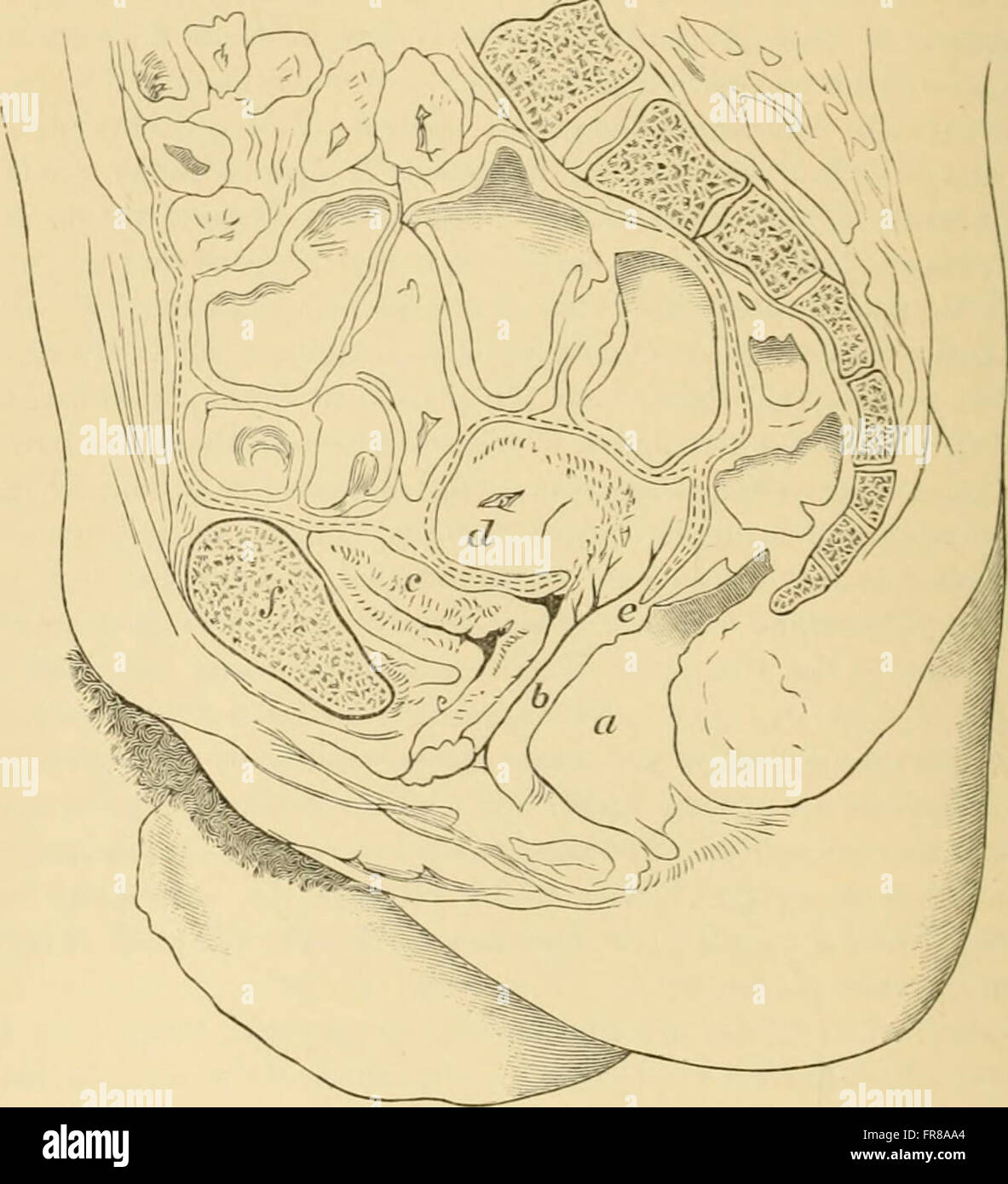 A System of Gynecology (1887) provides an in-depth study of women's ...