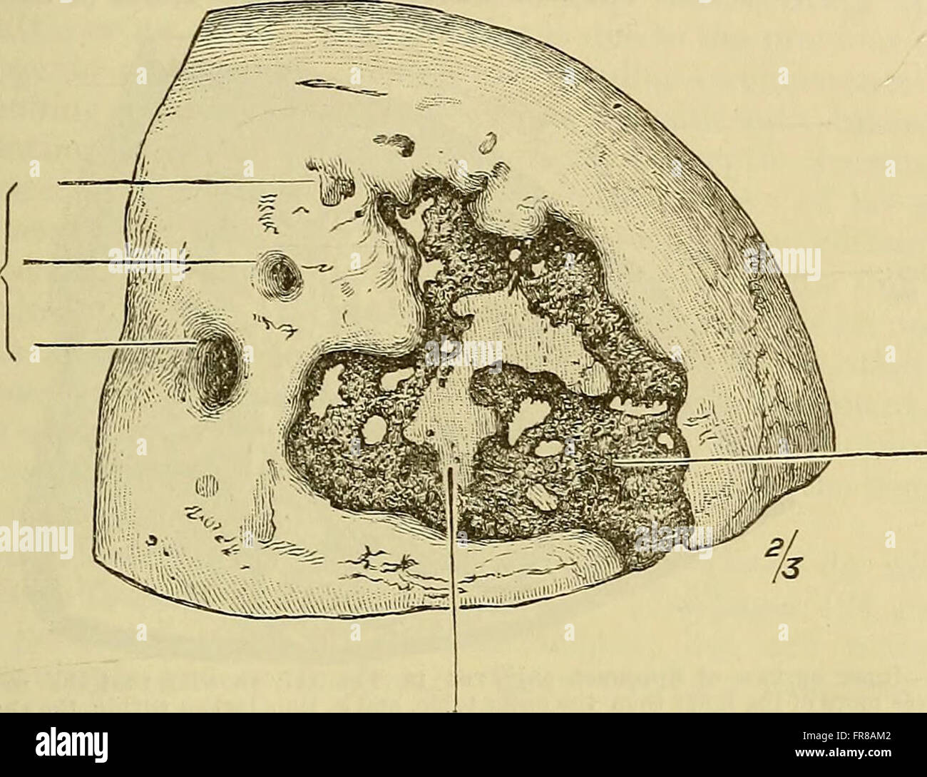 This text outlines a comprehensive system of surgery from 1895 ...
