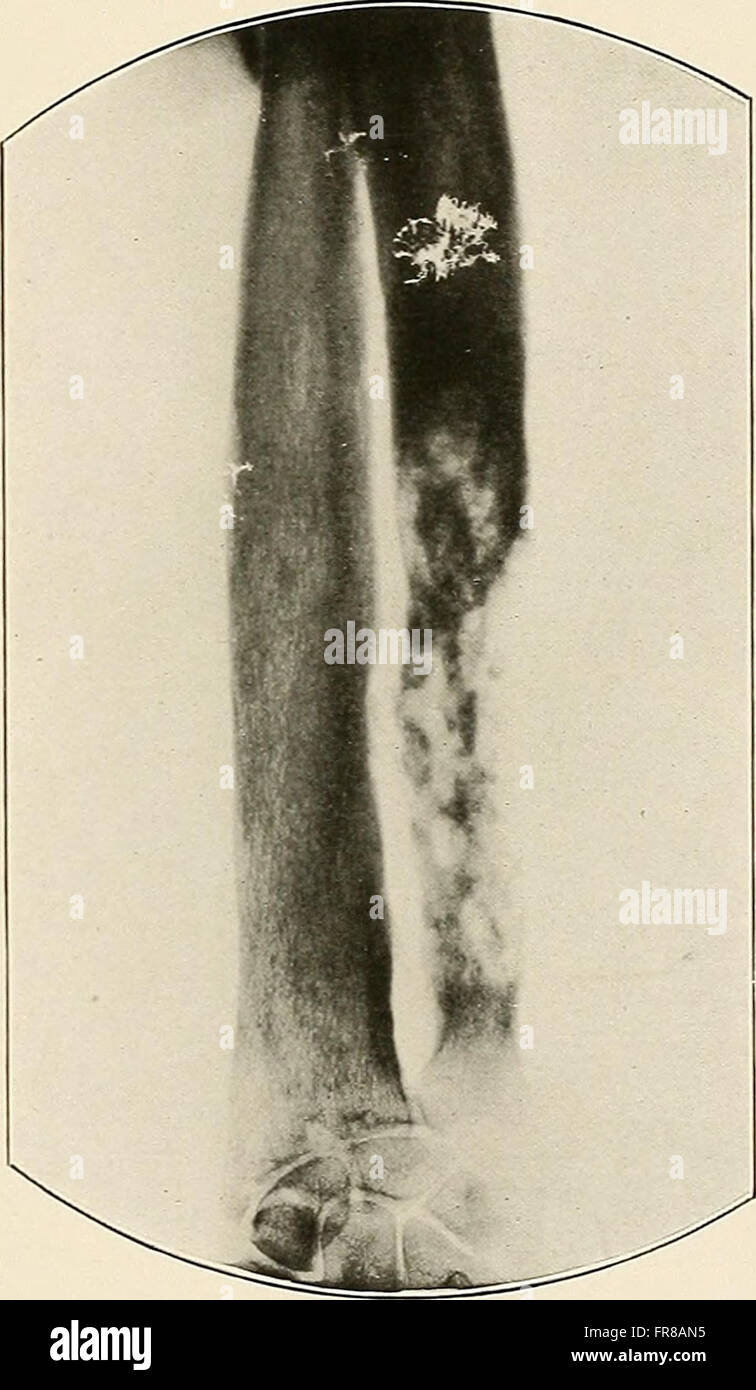 Pathologic changes hi-res stock photography and images - Alamy