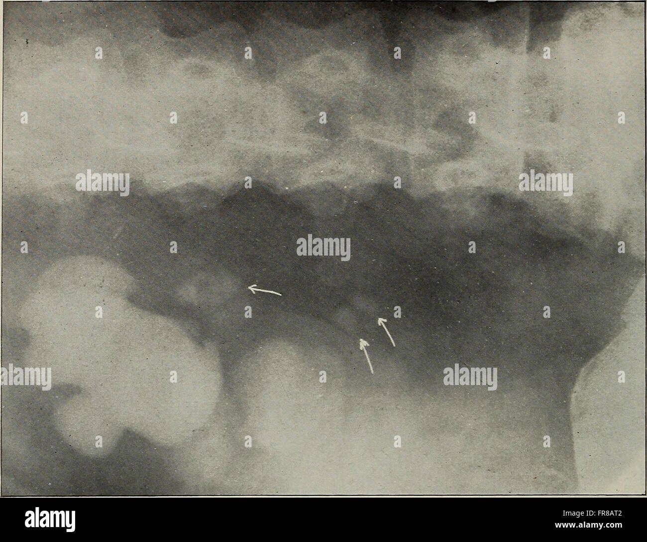The American Quarterly of Roentgenology (1911) publishes research on ...