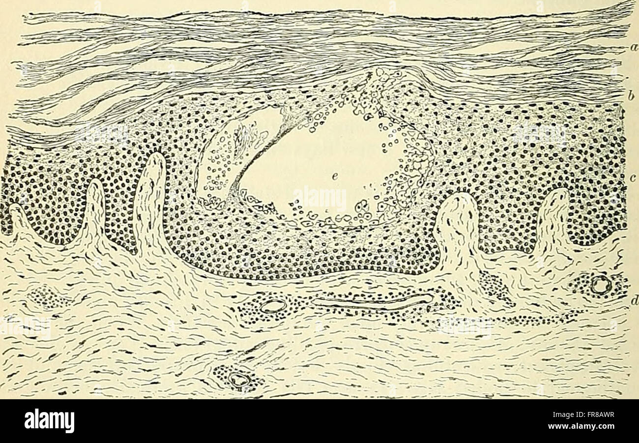 An American text-book of genito-urinary diseases, syphilis and diseases ...
