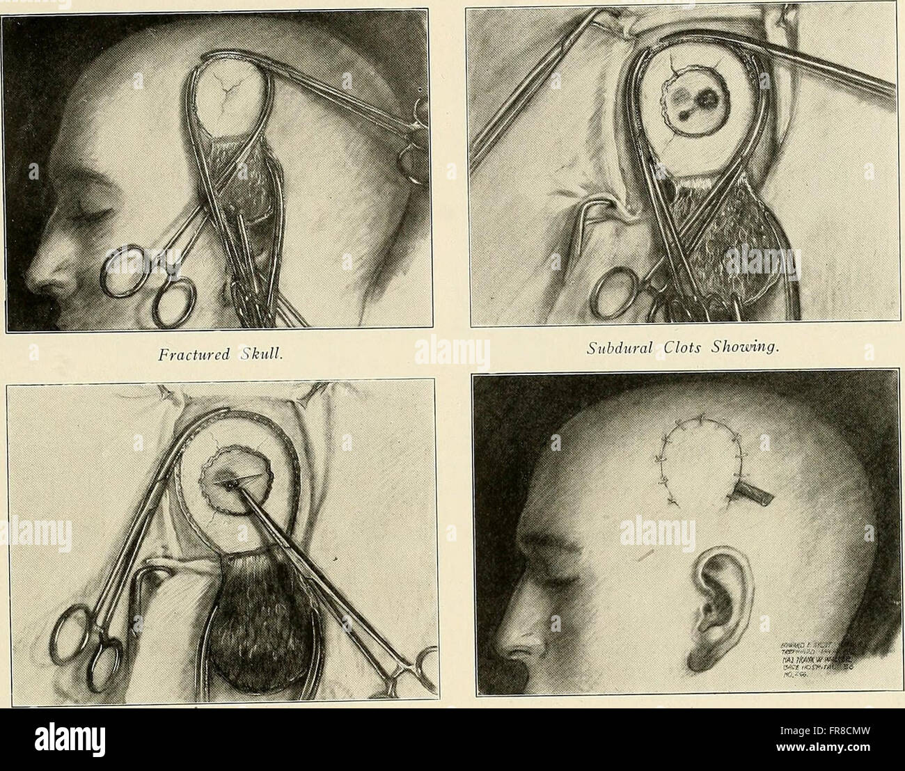 Detroit army base hi-res stock photography and images - Alamy