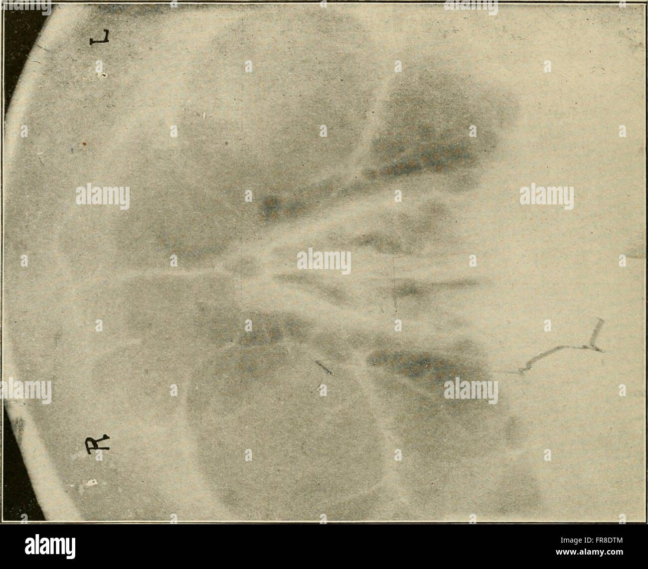 Elementary and dental radiography by howard riley raper 1918 hi-res ...